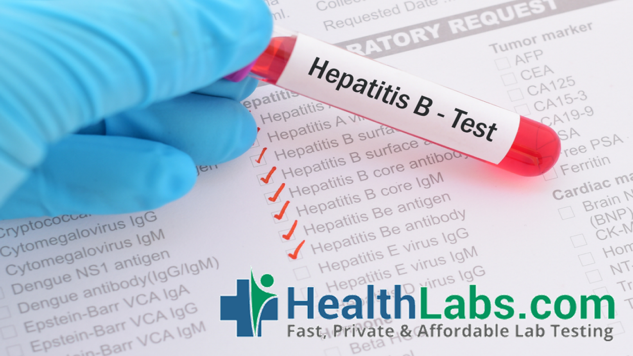 Healthlabs Hepatitis B Surface Antigen Test | Affiliates Dispatch